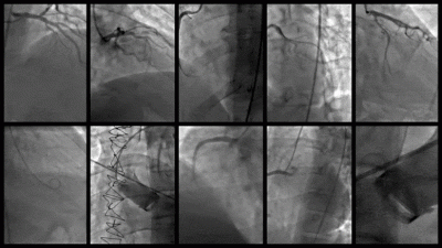 Health News - Page 219 of 303 - SciTechDaily