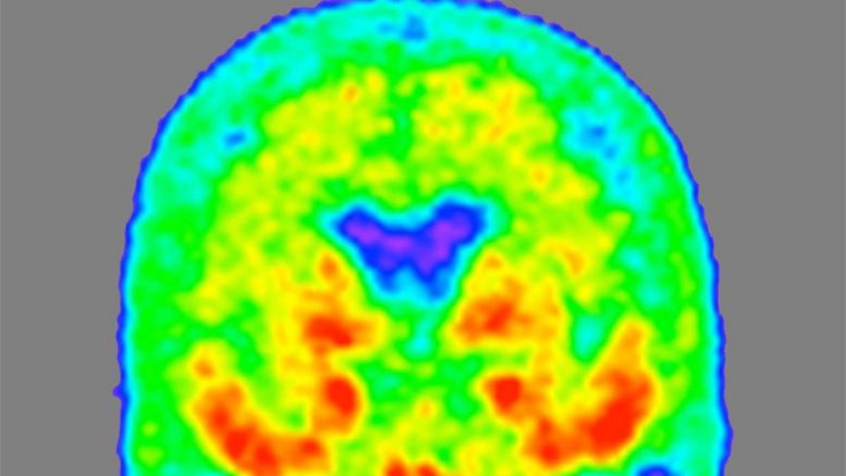 Tau Ceti May Host a Habitable Planet