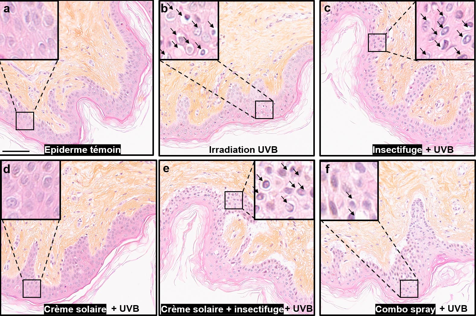 Researchers Uncover Hidden Risk in Popular Summer Skincare Combo