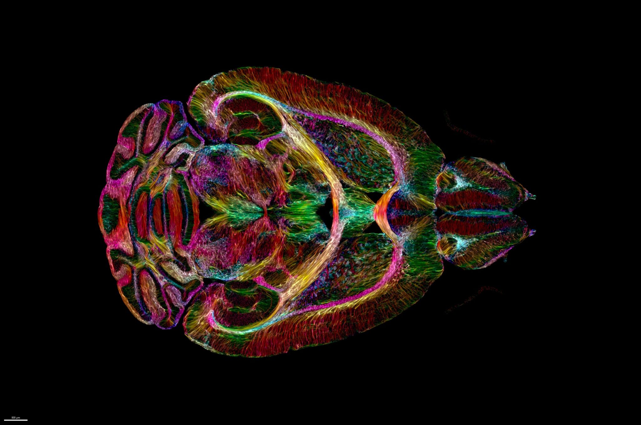 Brain Imaging Breakthrough: 64 Million Times Sharper