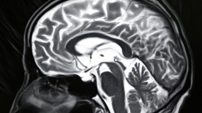 Understanding Dyscalculia and How the Brain Processes Numbers