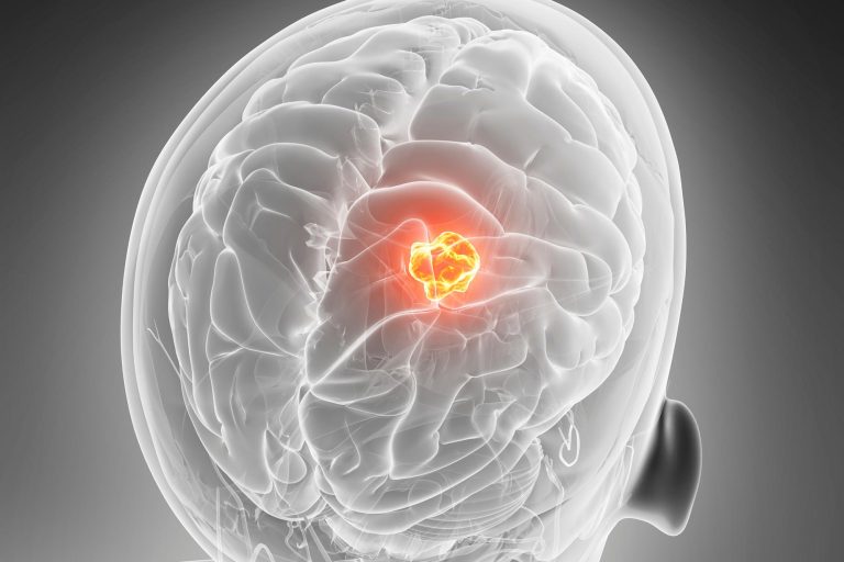 Deadly Timekeeping: How Brain Tumors Use Your Body Clock Against You