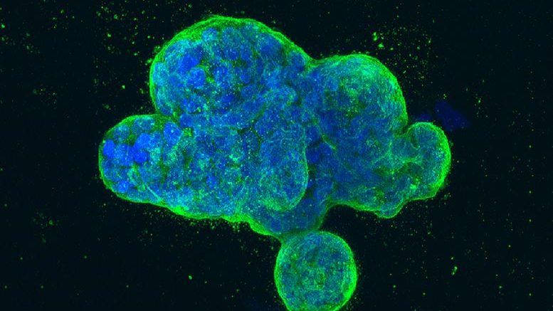 Researchers Find a New Target to Treat a Wide Spectrum of Cancers