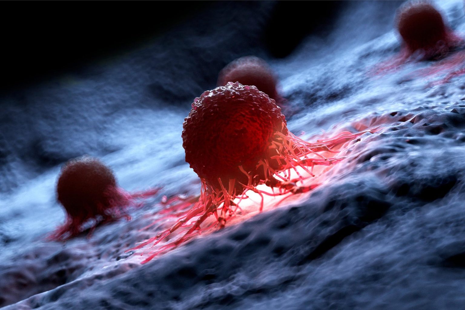 Surprise Discovery Reveals New Potential Path to Starving Cancer