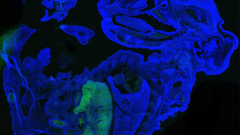 Cells Battle to the Death to Become Part of the Organism