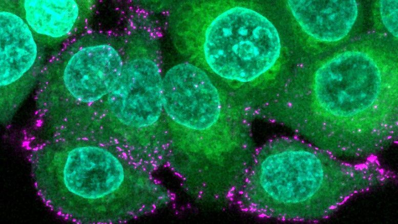 Startlingly New Images of SARS-CoV-2 Infected Cells – Ready to Spread ...
