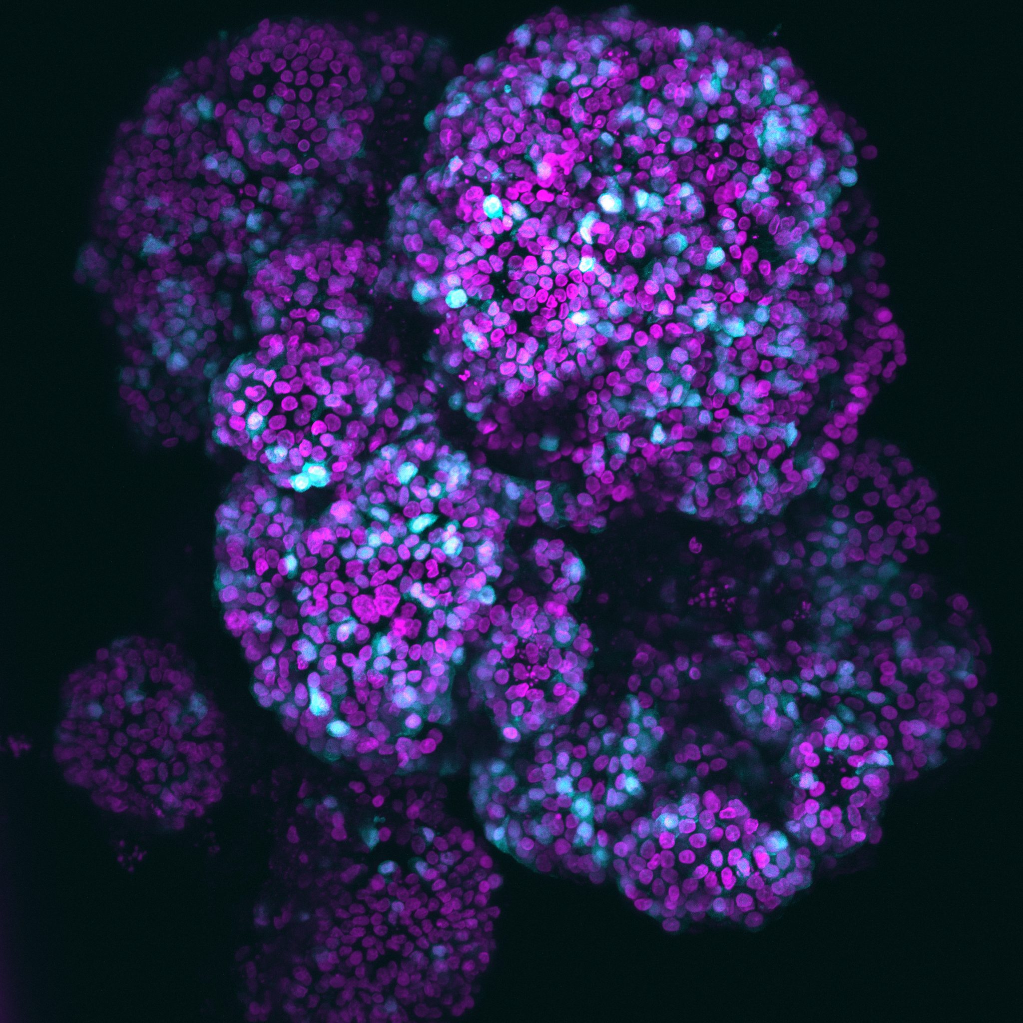New Organoid Mimics Human Fetal Pancreas, Unlocking Developmental Mysteries