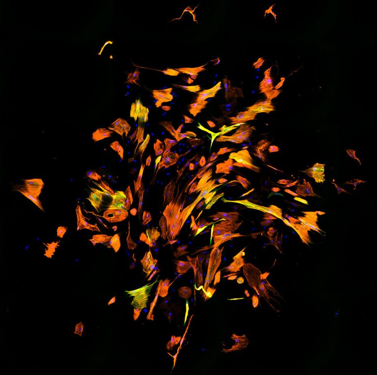 Newly Discovered Protein Partners Could Heal the Heart