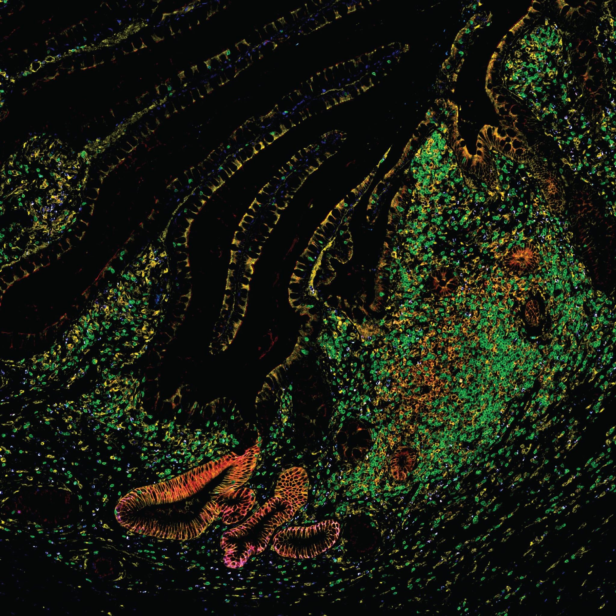 Largest Gut Cell Atlas Ever Created Reveals Hidden Links to Chronic ...