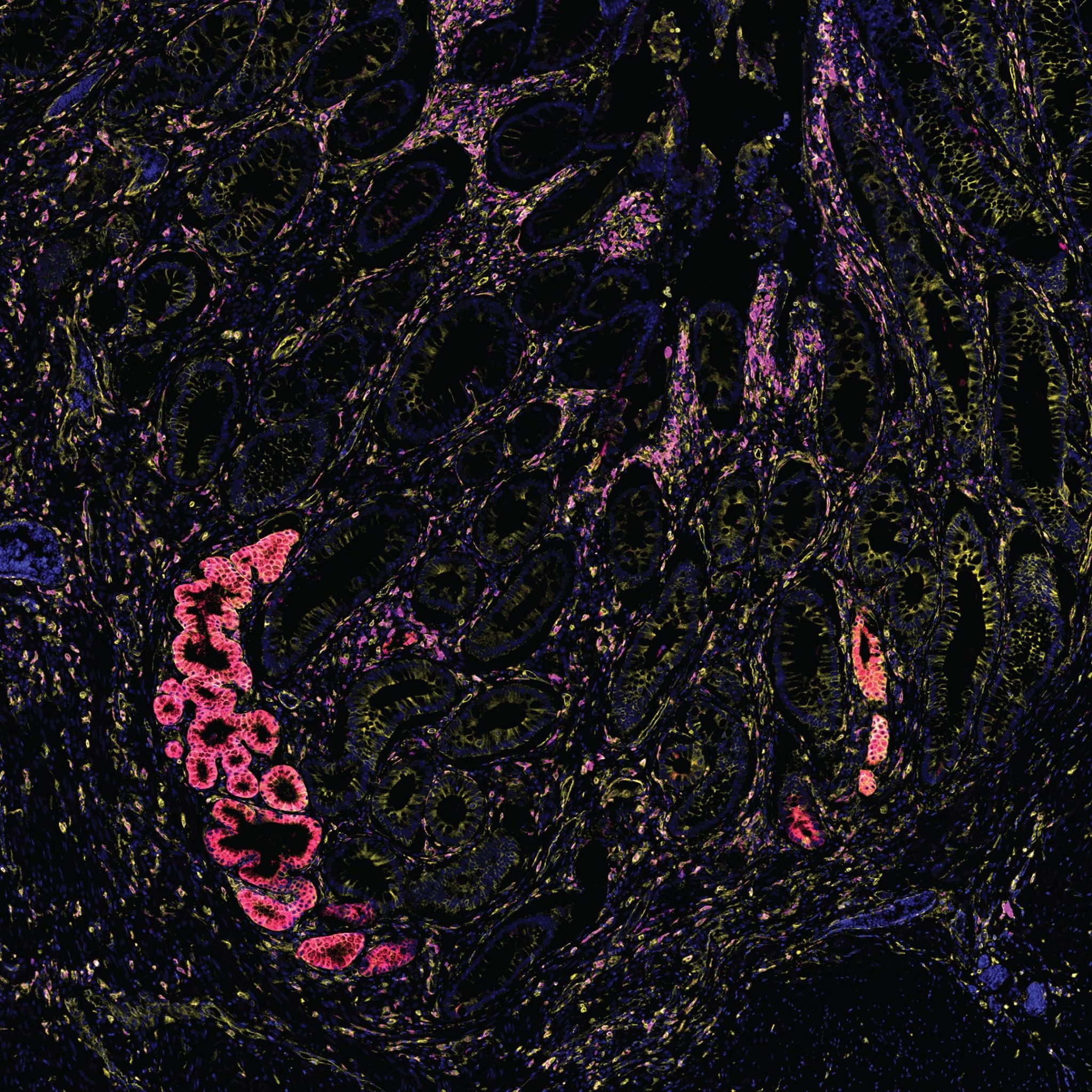 Largest Gut Cell Atlas Ever Created Reveals Hidden Links to Chronic ...