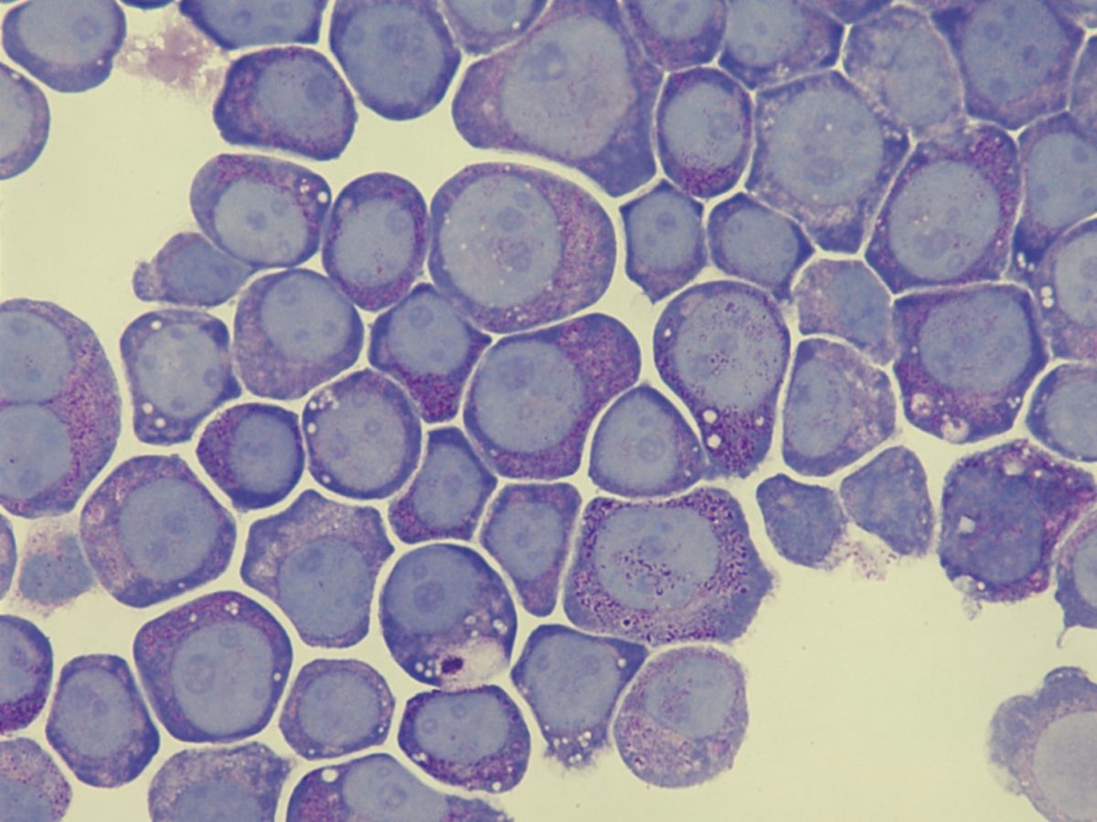 What It Takes To Make a White Blood Cell Could Unlock New Cancer Treatments