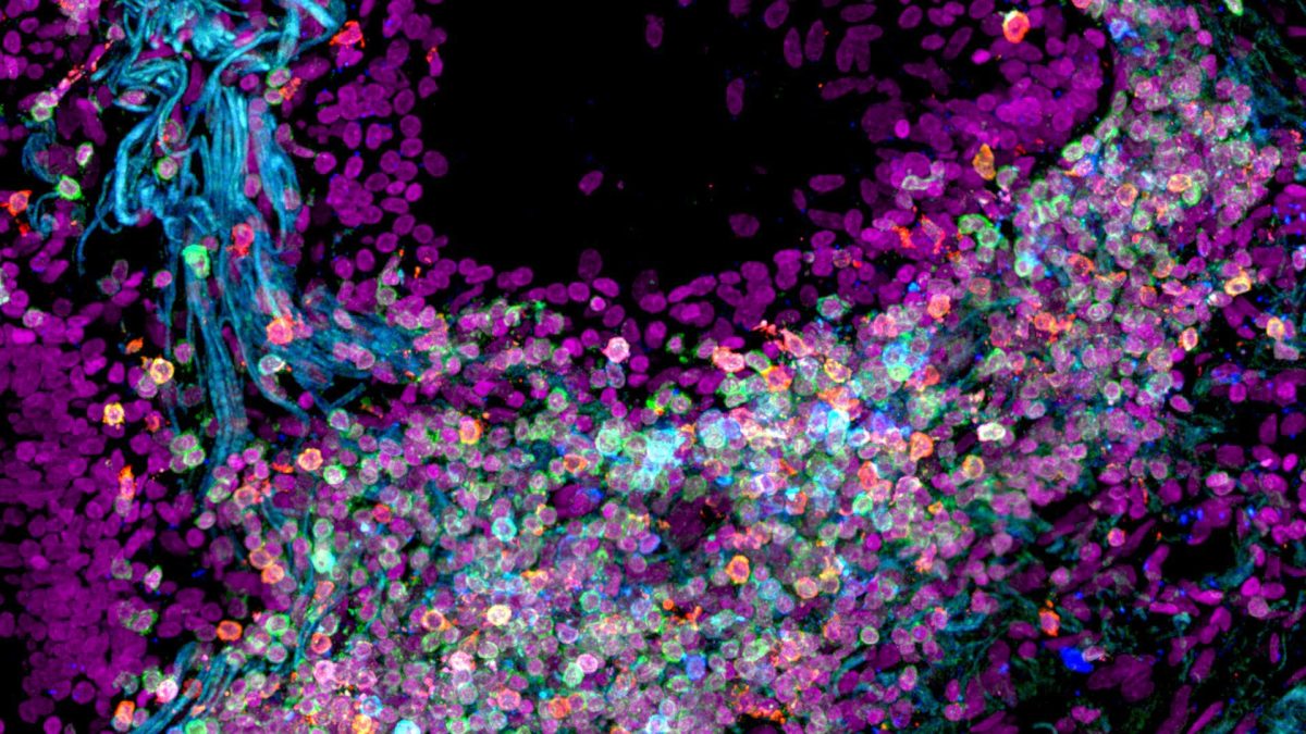 Building a “Google Maps” for Biology: Human Cell Atlas Revolutionizes ...