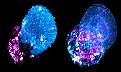 Lab-Grown Mini Lungs: Accelerating Respiratory Disease Research