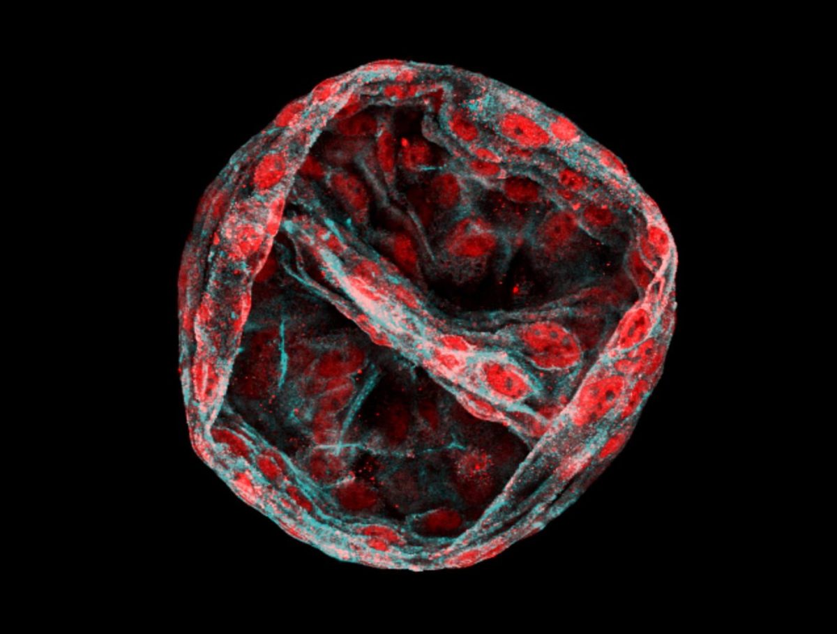 Metabolic Enzymes Go Nuclear, Paving the Way for Breakthrough Cancer Cures