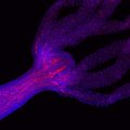 How Hydra – A Group of Small Aquatic Animals – Regenerate Their Own Heads
