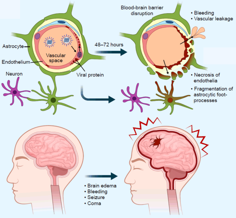 How the Flu Virus Sneaks Into the Brain and What We Can Do About It