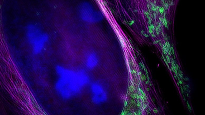 Researchers Develop High-Speed Super-Resolution Microscope With a Large ...