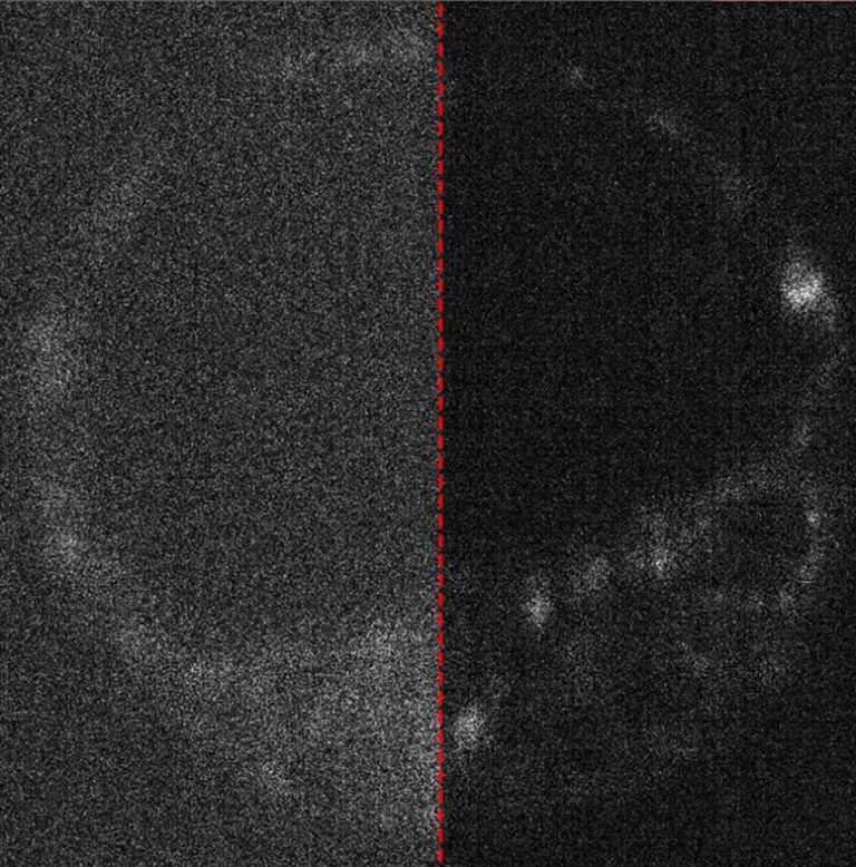Quantum Cameras Capture Life’s First Moments