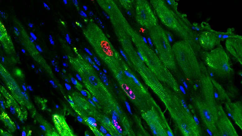 Human Cardiac Cells Derived from Stem Cells Could Repair Damaged Hearts