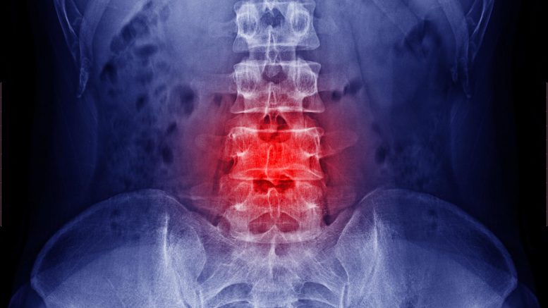 Hubble Image of the Week: Galaxy NGC 6052