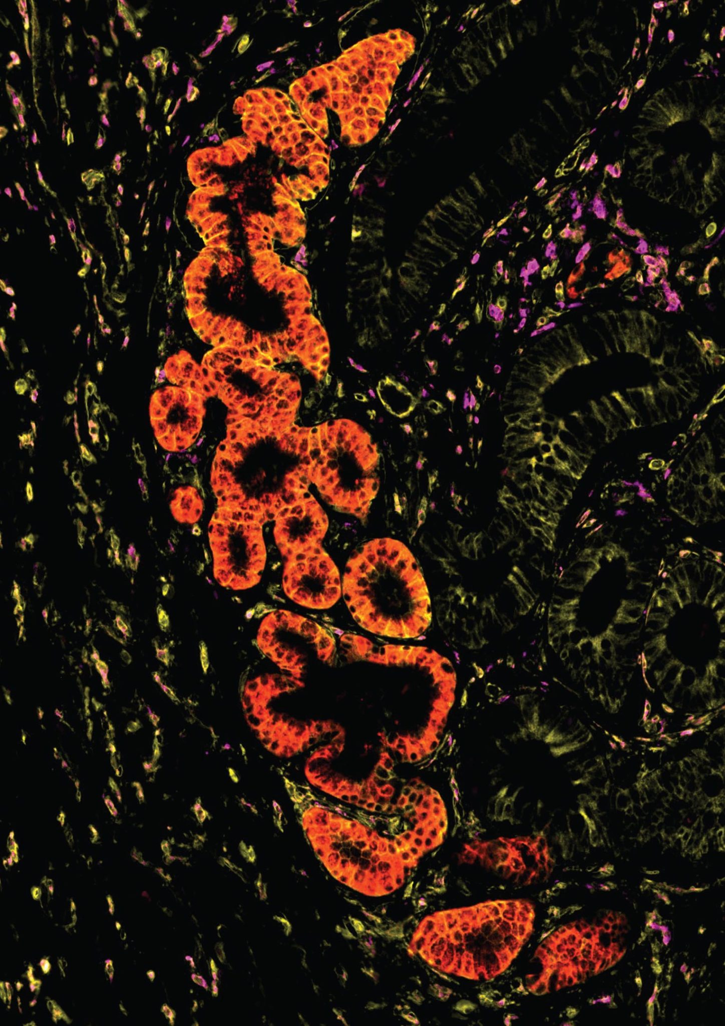 Largest Gut Cell Atlas Ever Created Reveals Hidden Links to Chronic ...
