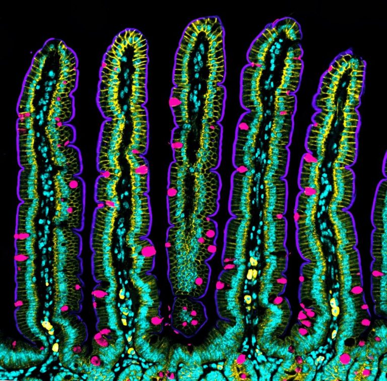 Researchers Discover How the Intestinal Epithelium Folds and Moves by ...