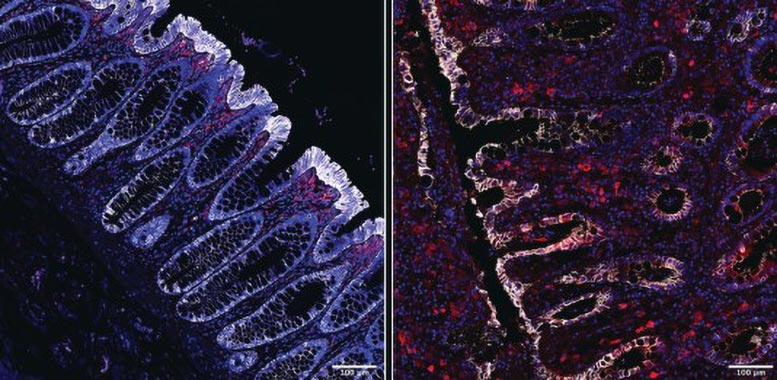 A High-Fiber Diet Could Save Your Life, According to New Study