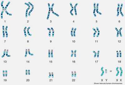 The Surprising Influence of Sex Chromosomes on Whole-Body Gene Expression