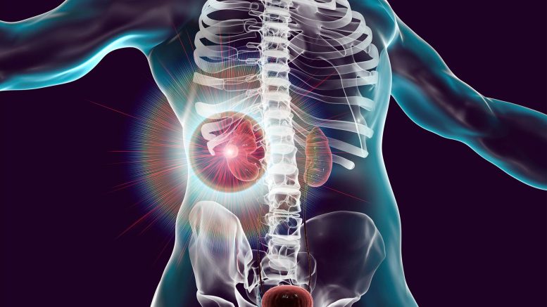 A New Study Has Identified Genes Associated With the Most Aggressive ...