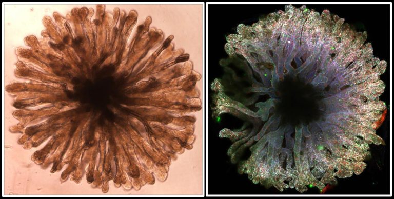Scientists Make Big Progress in Building Mini-Kidneys – "Essential ...