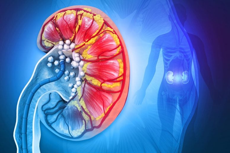 Scientists Discover Living Bacteria Hidden Inside the #1 Type of Kidney ...