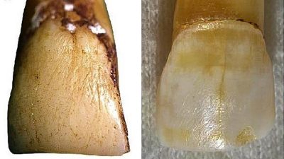 Strange Tooth Discovery Prompts Rethink of Human Evolution