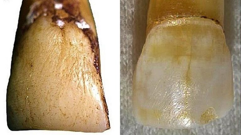 Strange Tooth Discovery Prompts Rethink of Human Evolution