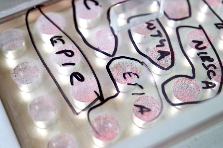 This Tiny Brain Grown in a Lab Could Revolutionize Mental Health Research