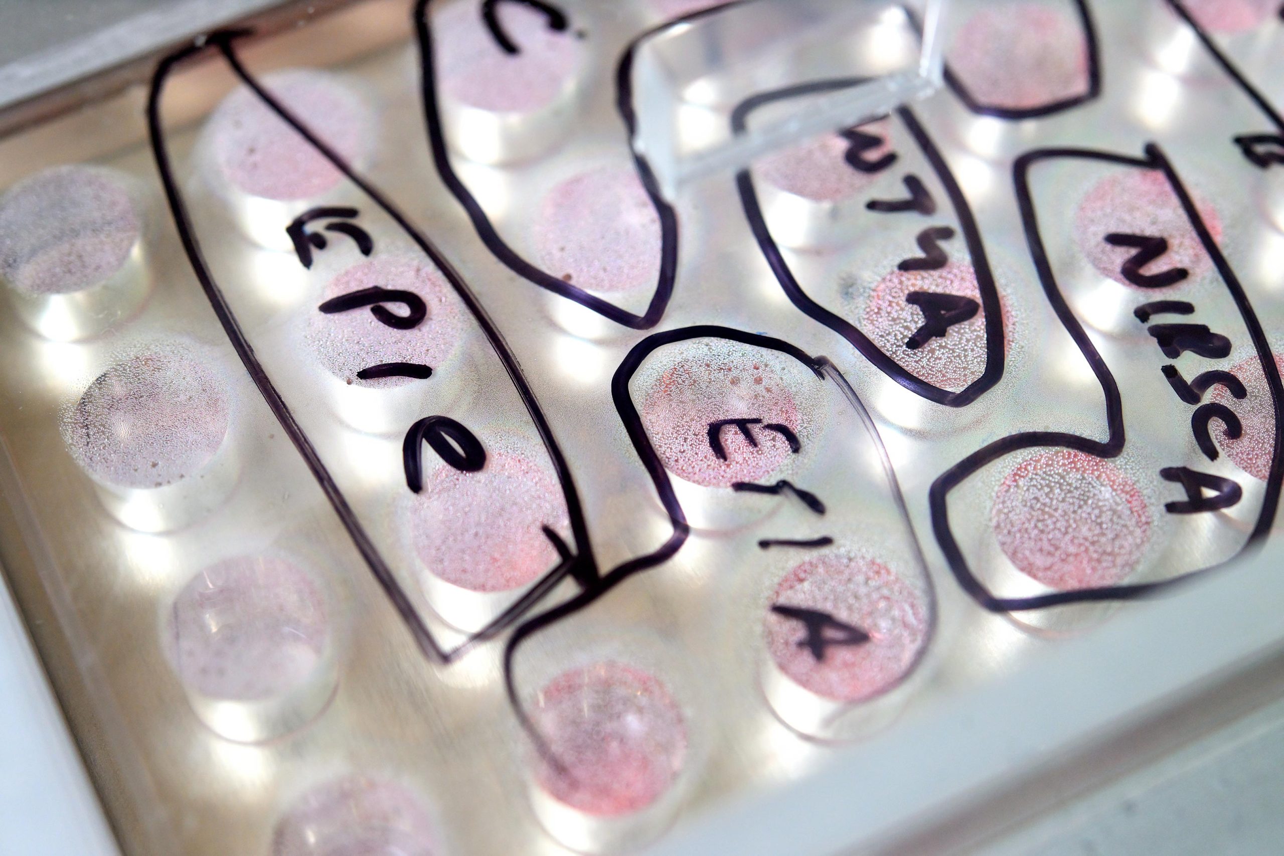 This Tiny Brain Grown in a Lab Could Revolutionize Mental Health Research