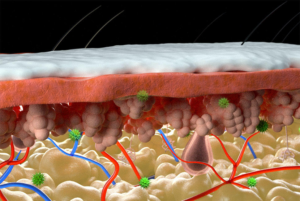 New “Super Melanin” Cream Heals Skin Injuries From Sunburn, Chemical Burns