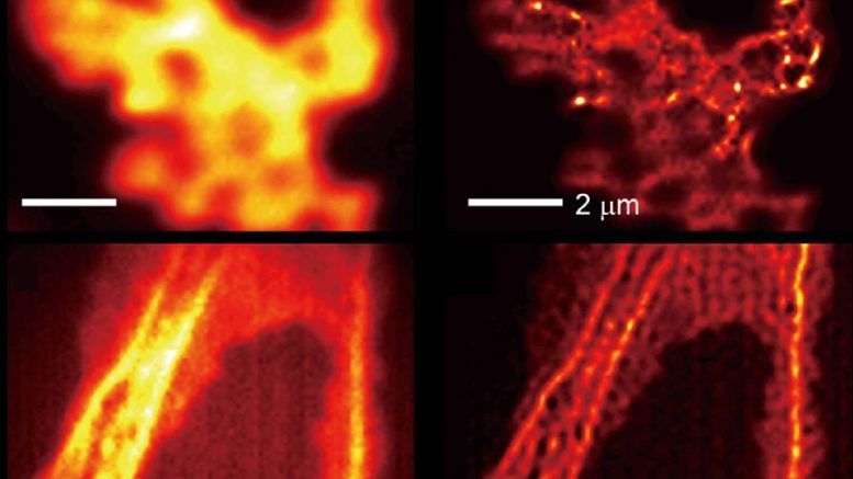 Researchers Develop High-Speed Super-Resolution Microscope With a Large ...