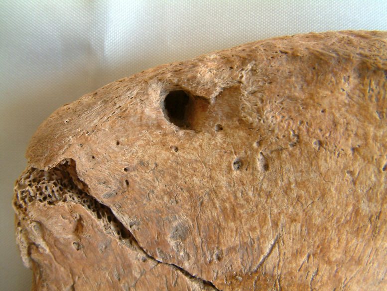 Gladiator vs. Lion: 1,800-Year-Old Skeleton Reveals Deadly Showdown