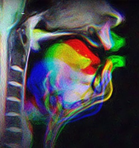 Brain Study Overturns Long-Held Beliefs About How Humans Learn Speech