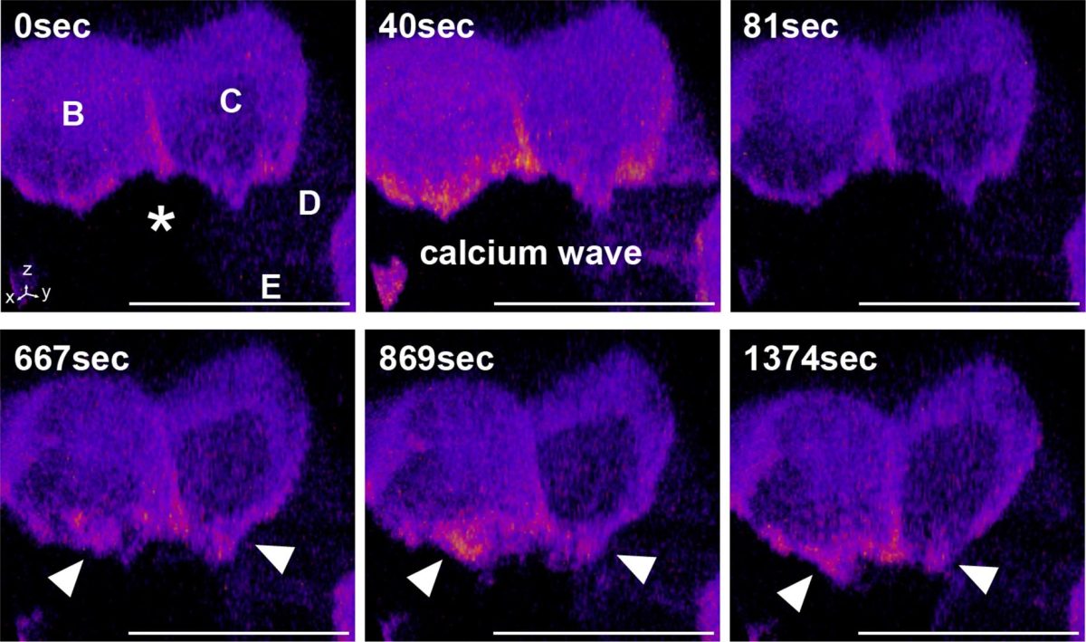 Guarding Life: How Calcium Transforms Cell Death Into Defense