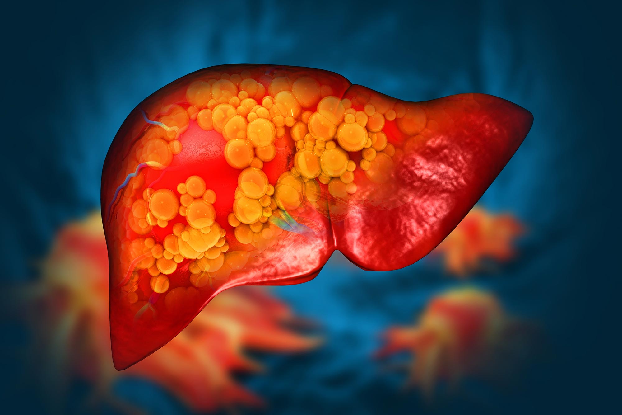 The Sugar Pathway That Links Alcohol Addiction and Liver Damage