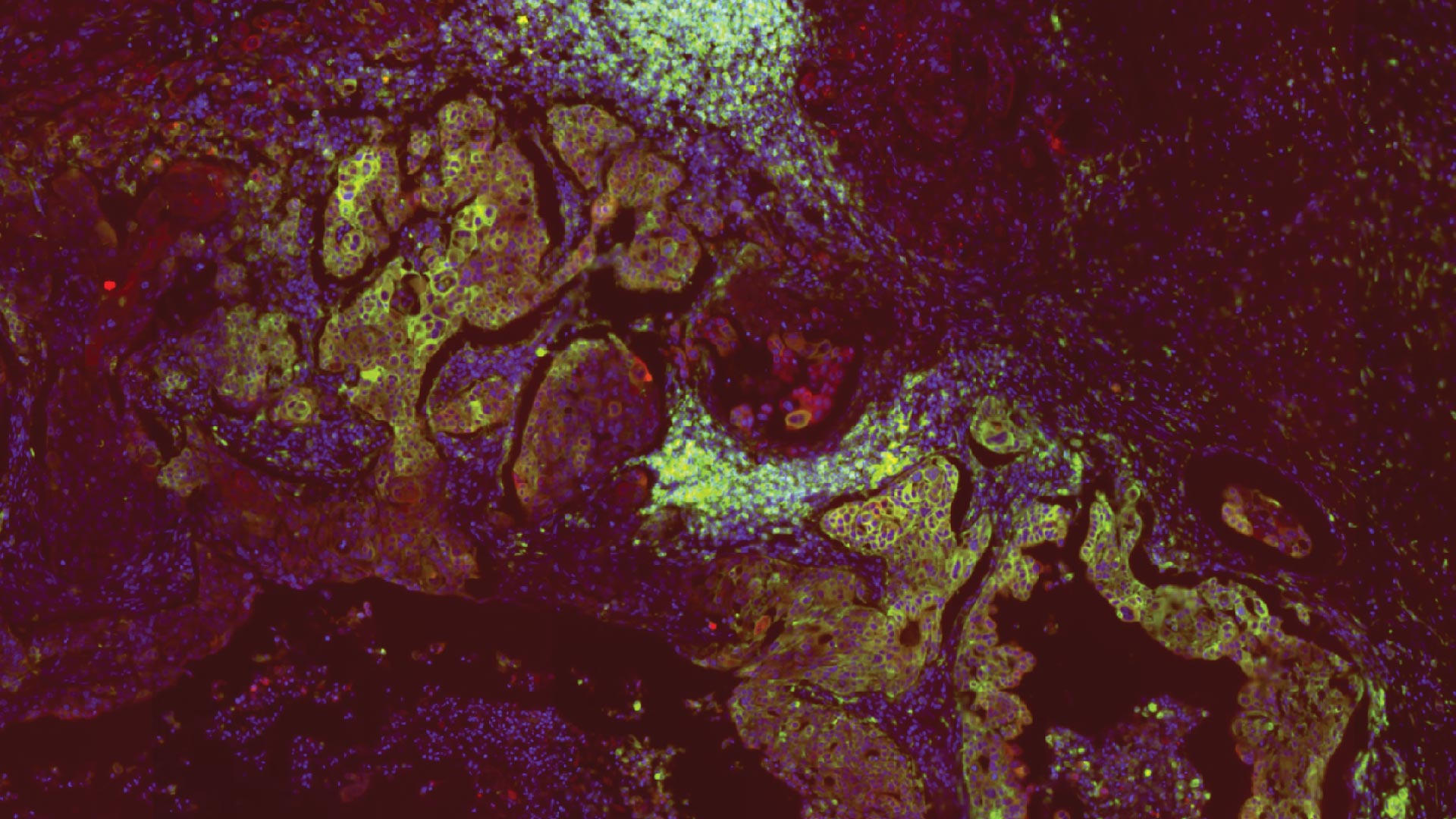 Cold Spring Harbor Laboratory News - SciTechDaily