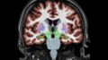 Study Shows Electrical Activity in the Brain after Clinical Death