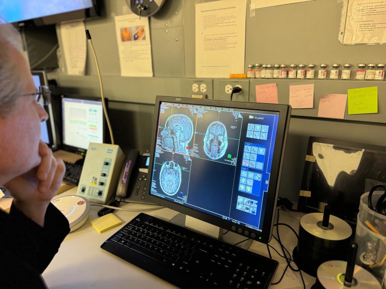 How Your “Lizard Brain” Fuels Overthinking and Social Anxiety