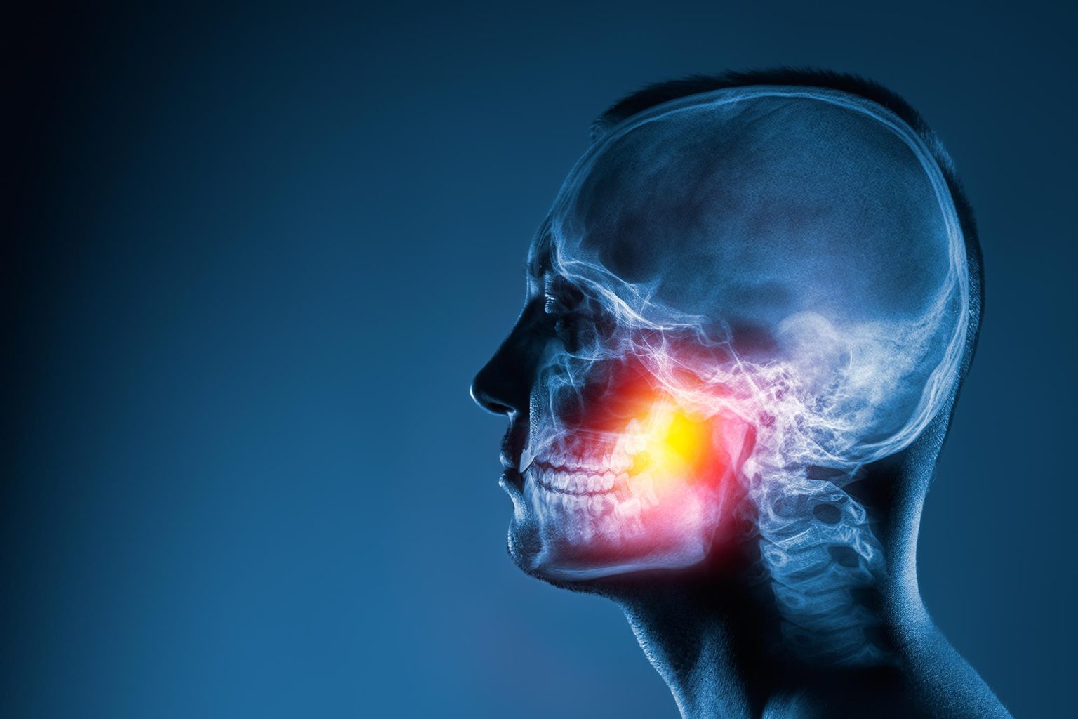 Doctors Warn: Popular Bone Medications May Cause Serious Jaw Disease