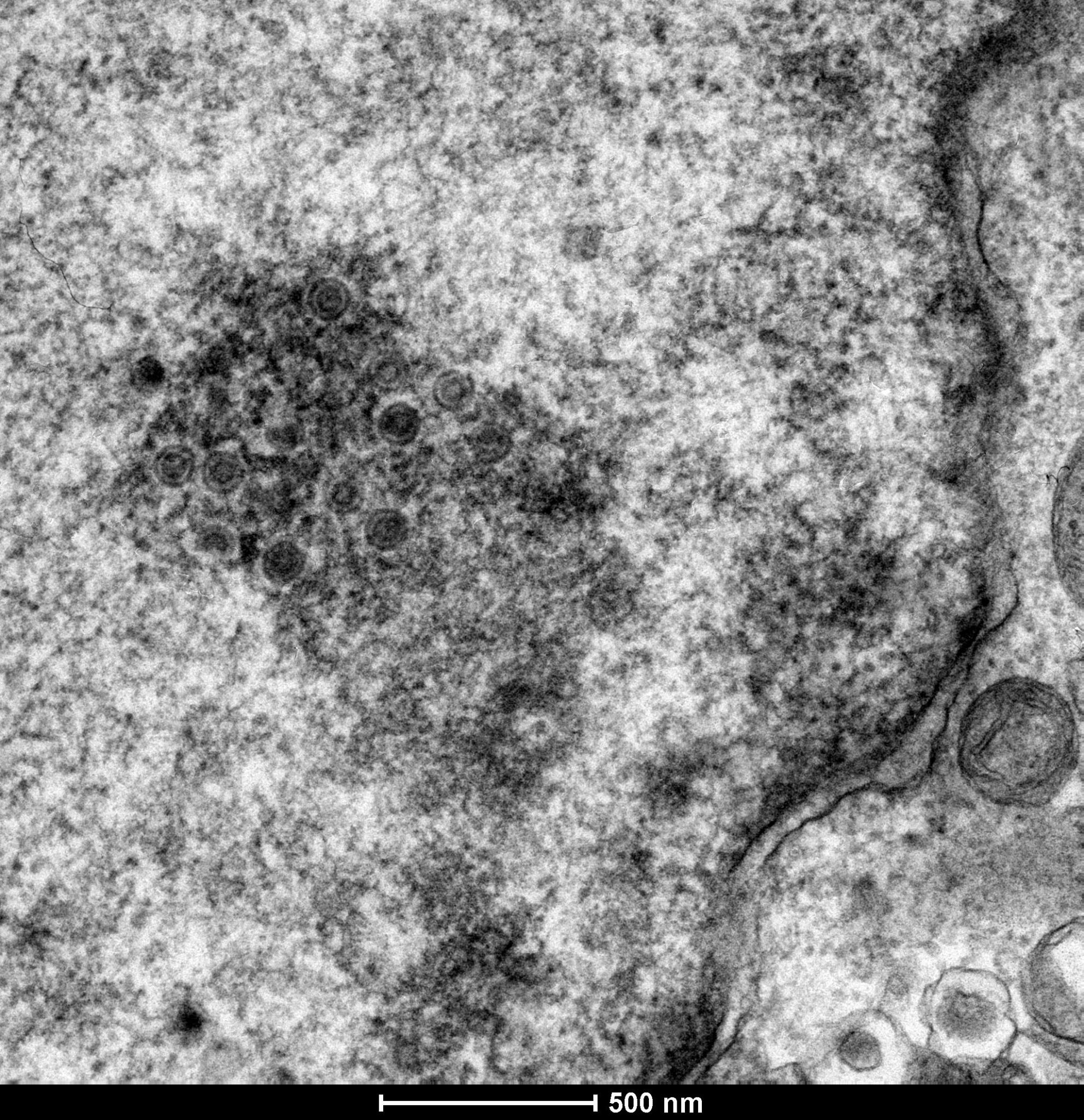 Deadlier With Time: Ancient DNA Reveals a Chicken Virus’ Evolutionary Leap