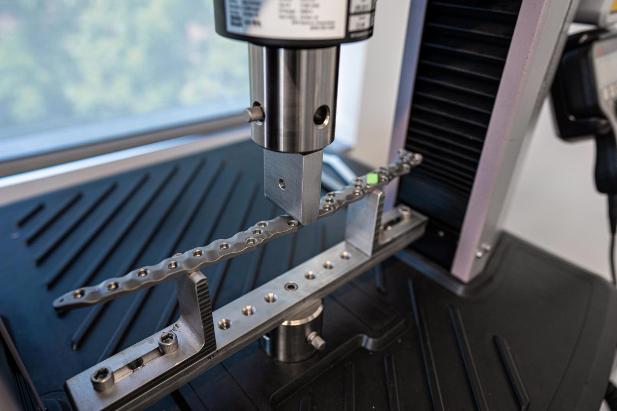 How Tiny Smart Sensors Are Fast-Tracking Bone Recovery