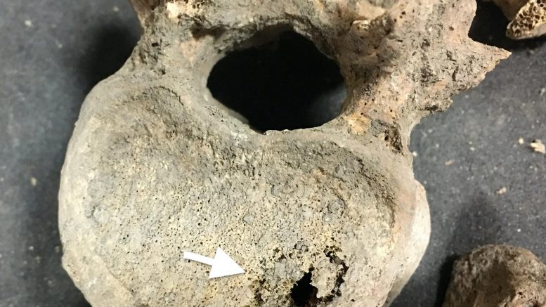 Medieval England Birch Bark Tar Usage Revealed in New Archaeological ...