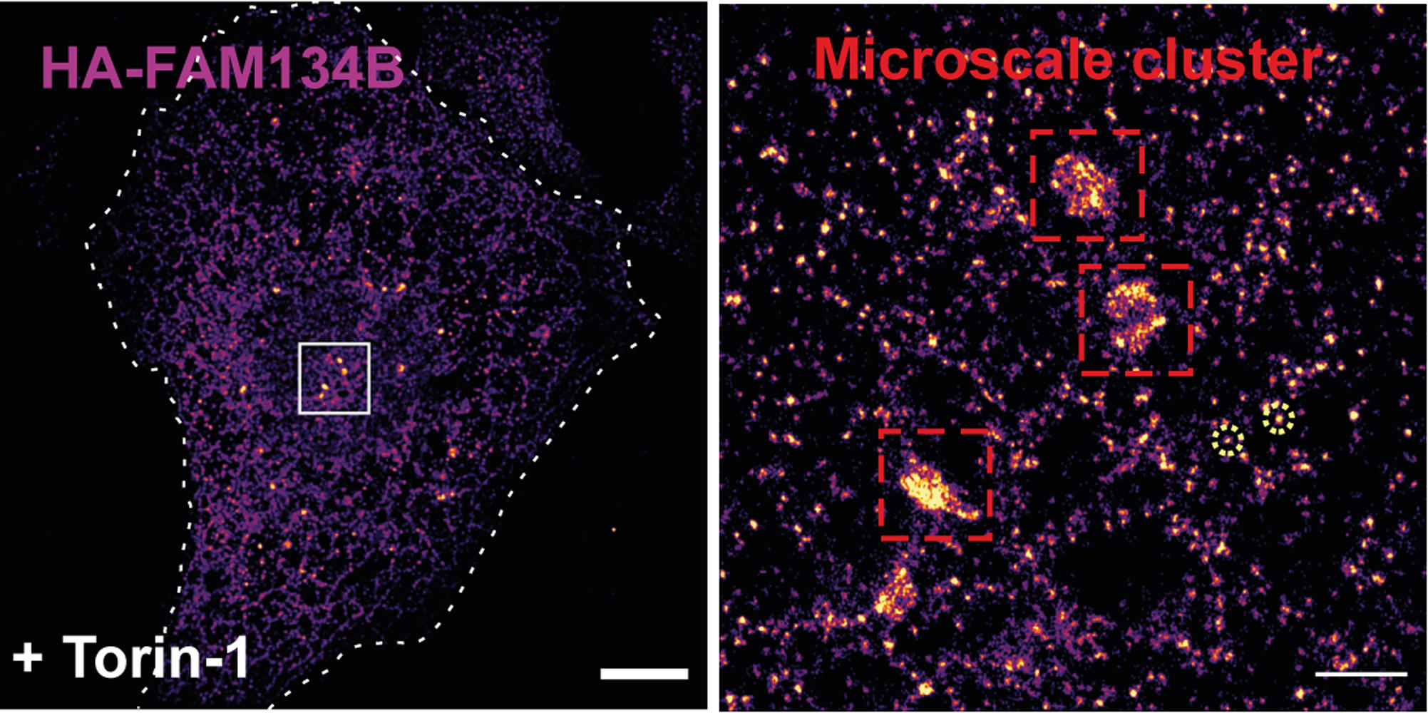 When the Cell Digests Itself – Unraveling the Origins of ...