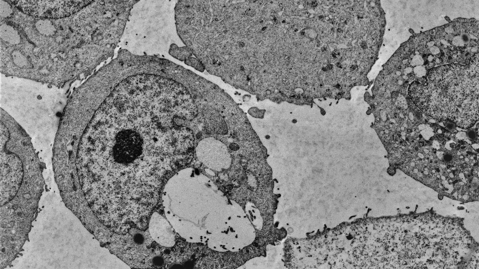 Scientists Have Discovered a Simple Supplement That Causes Prostate ...